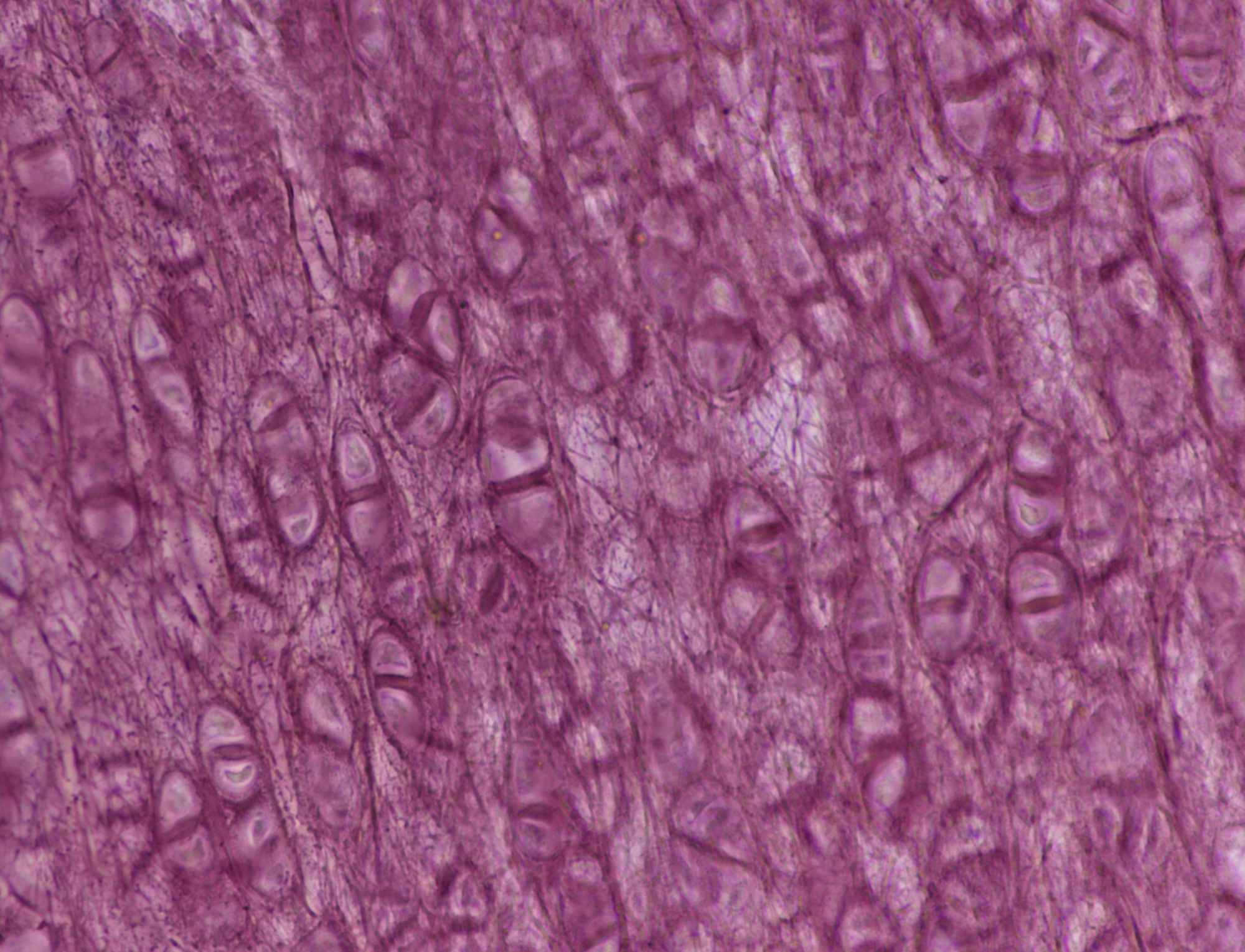 МИКРОСКОПИЧЕСКИЕ ФОТОГРАФИИ - СОЕДИНИТЕЛЬНАЯ ТКАНЬ - ХРЯЩ, СУХОЖИЛИЕ