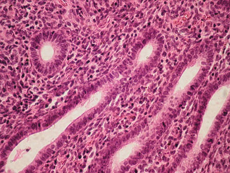 MICROSCOPIC HISTOLOGY IMAGES - FEMALE REPRODUCTIVE SYSTEM - UTERUS ...