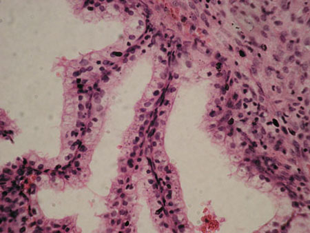 MICROSCOPIC HISTOLOGY IMAGES - FEMALE REPRODUCTIVE SYSTEM - UTERUS ...