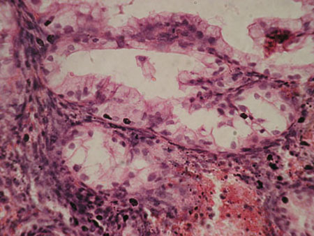 MICROSCOPIC HISTOLOGY IMAGES - FEMALE REPRODUCTIVE SYSTEM - UTERUS ...