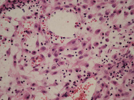 MICROSCOPIC HISTOLOGY IMAGES - FEMALE REPRODUCTIVE SYSTEM - UTERUS ...