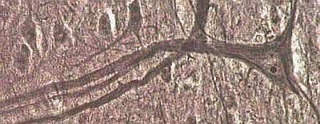 MICROSCOPIC HISTOLOGY IMAGES - NERVOUS TISSUE